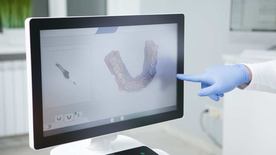 intraoral camera | Rose Dental